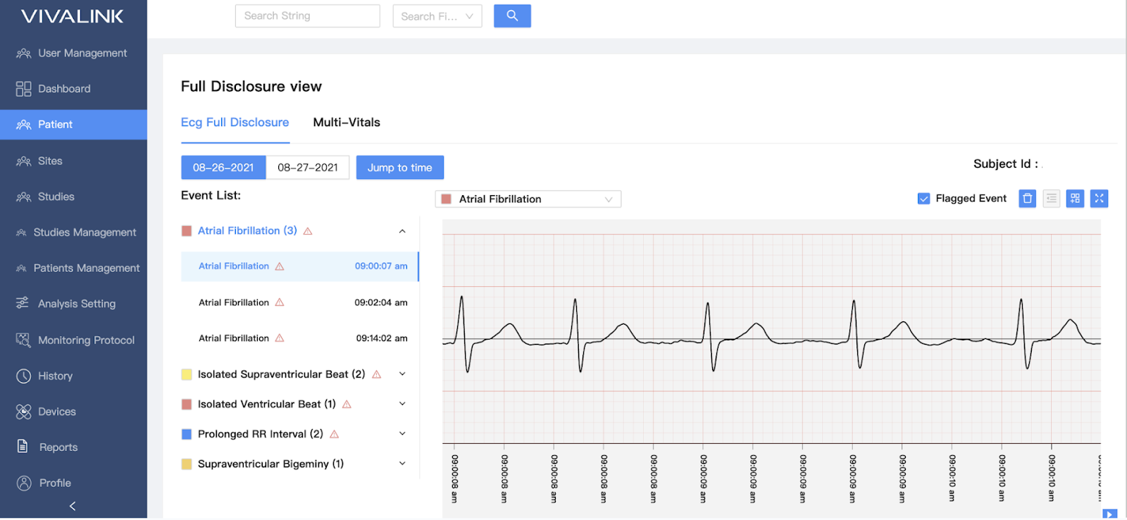 ECG Full Disclosure View – Help Center